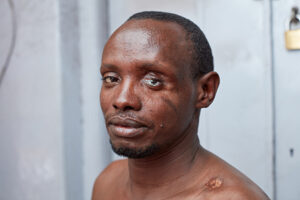 Joseph Maina Githinji – Decriminalise Poverty & Status